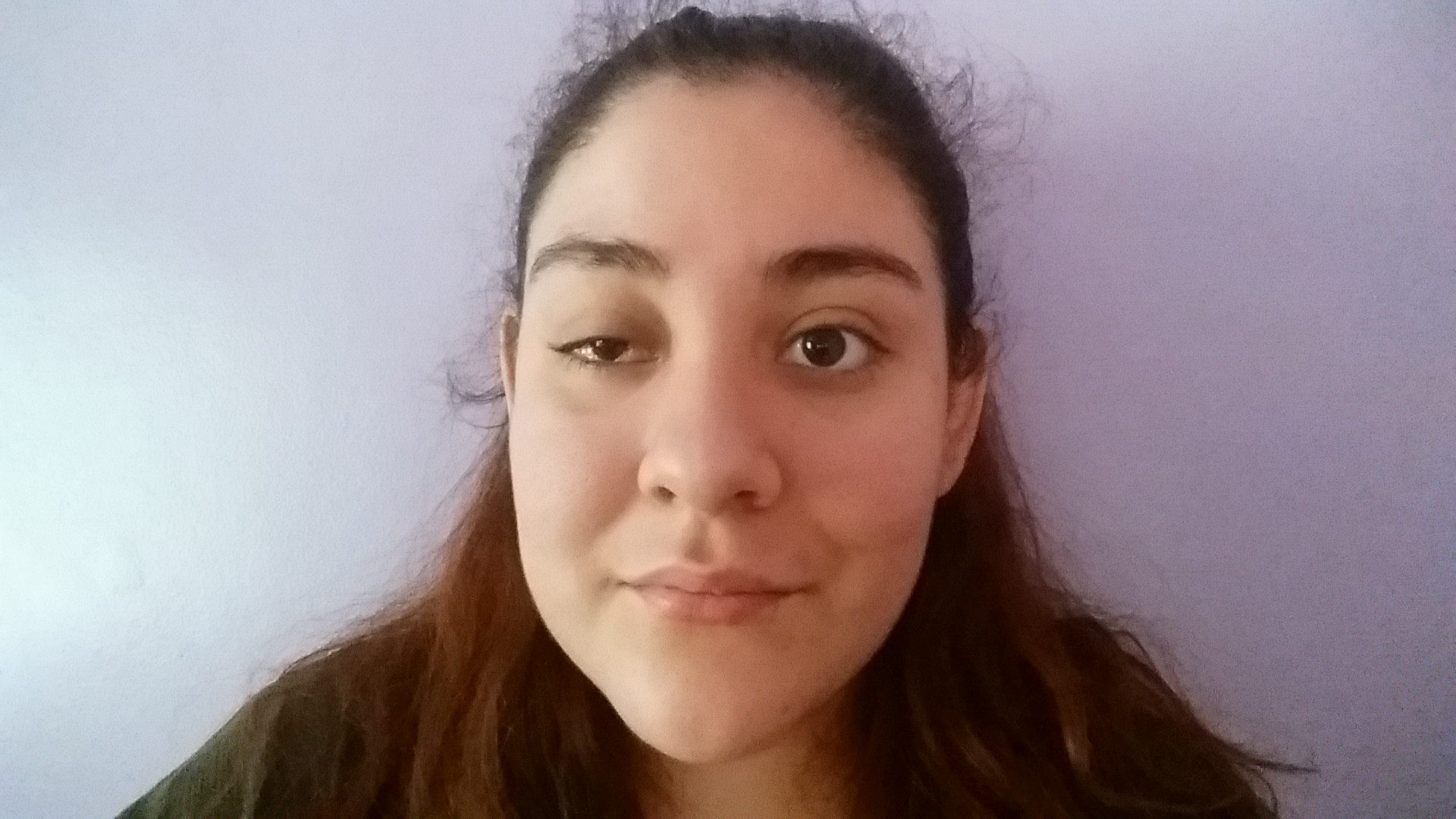 All About Strabismus (Crossed Eyes) – Little Baby Face