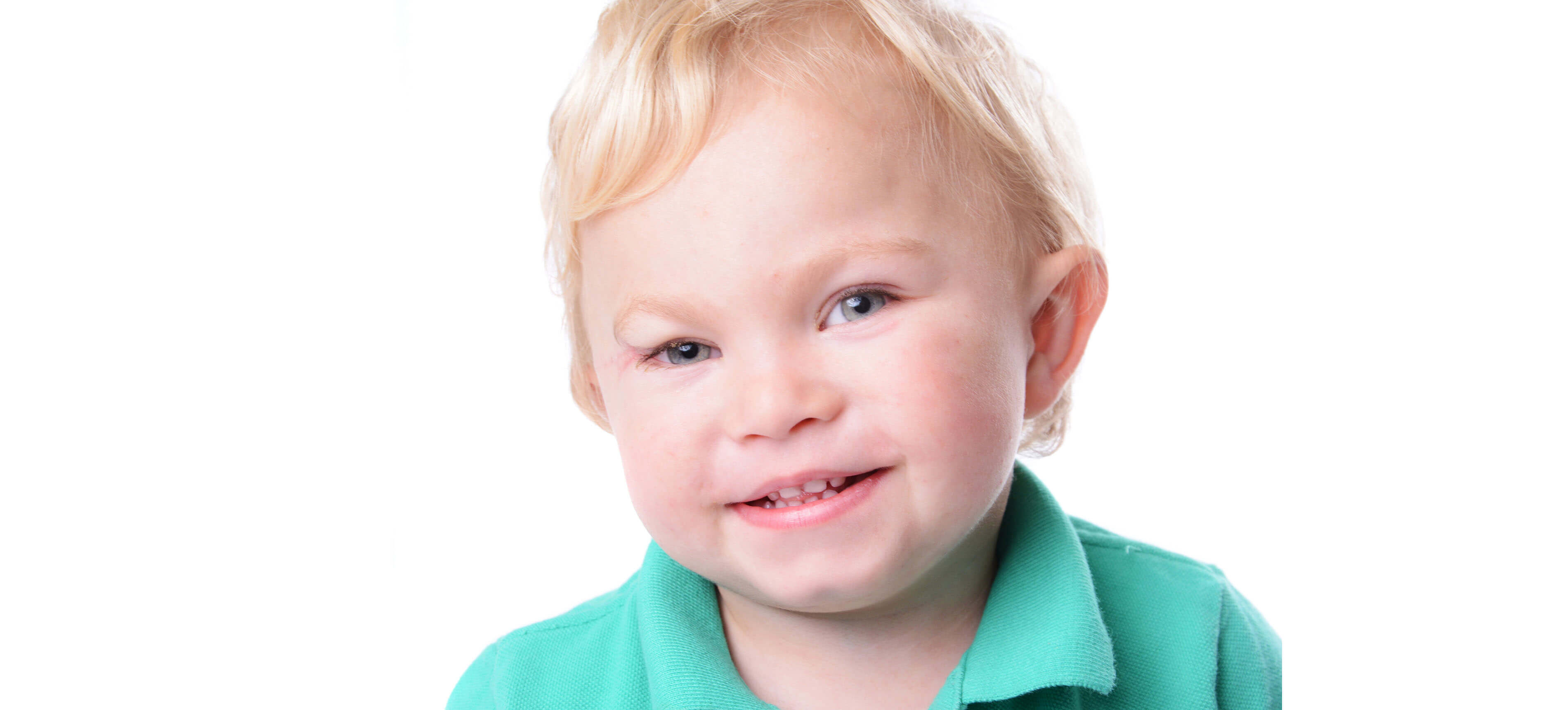 Little Baby Face Foundation | Facial Birth Deformity Corrections