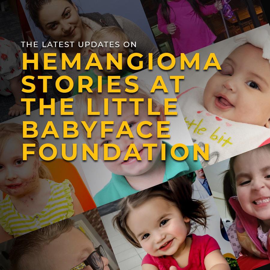 Little Baby Face Foundation | Facial Birth Deformity Corrections