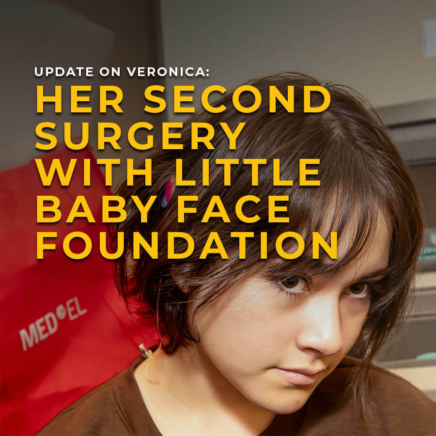 Little Baby Face Foundation | Facial Birth Deformity Corrections